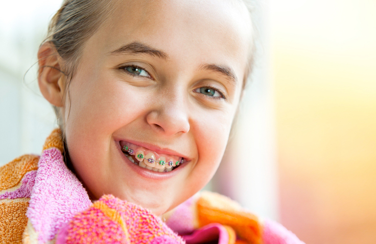 Tips on Choosing Braces Colours | Brown's Line Dental
